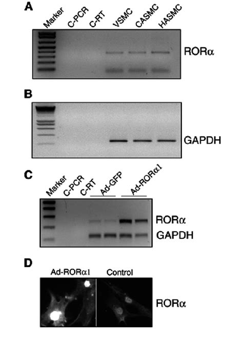 Rorα Is Expressed In Different Vascular Smc Types A And B Rt Pcr