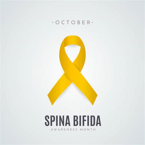 30 Spina Bifida Ilustraciones De Stock Gráficos Vectoriales Libres De
