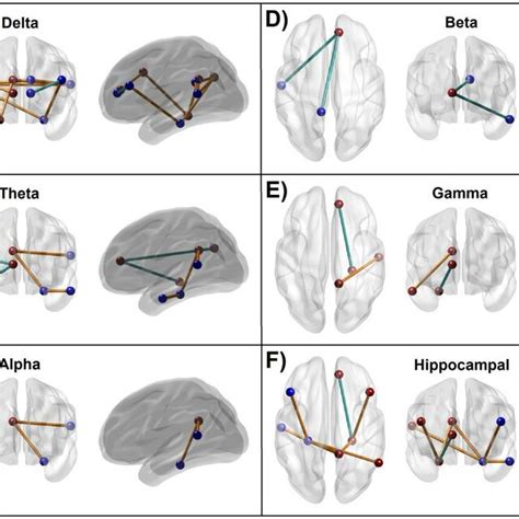 Panels A E Significant Default Mode Network Connections Within Each