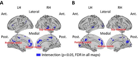 Robust Neural Alignment Effects In Medial And Temporal Cortical Regions
