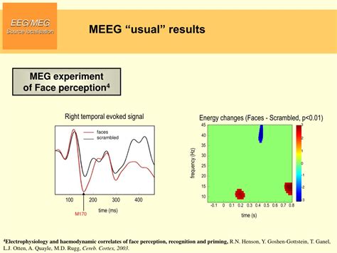 Ppt Eeg Meg Source Localisation Powerpoint Presentation Free