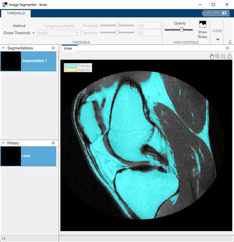 segment image using thresholding in image segmenter matlab and simulink