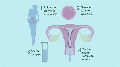 Iui Intra Uterine Insemination – Dr Preeti Mahawar