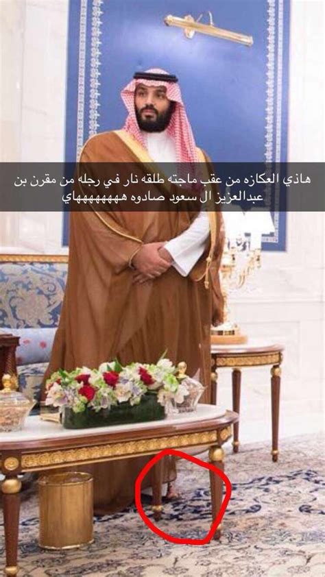 شاهد الصورة ظهور محمد بن سلمان على عكاز بعد اصابته بطلق نارب من قبل