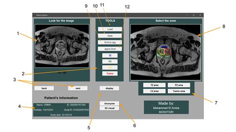 github amine0110 manual tumor segmentation