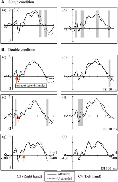 Frontiers Stimulus Intervals Modulate The Balance Of Brain Activity