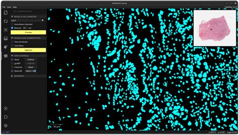 Cell Segmentation — Slideflow 2 2 0 Documentation