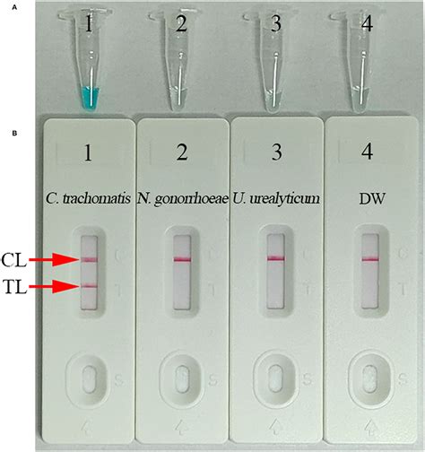 Frontiers Nanoparticle Based Lateral Flow Biosensor Integrated With