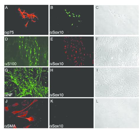 Expression Of Sox10 Protein In Neural Crest Stem Cells And Peripheral