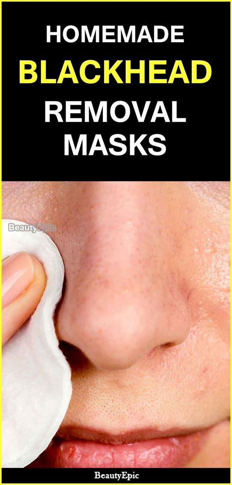 Blackhead Removal Mask 7 Diy Recipes And Benefits Blackhead Remover