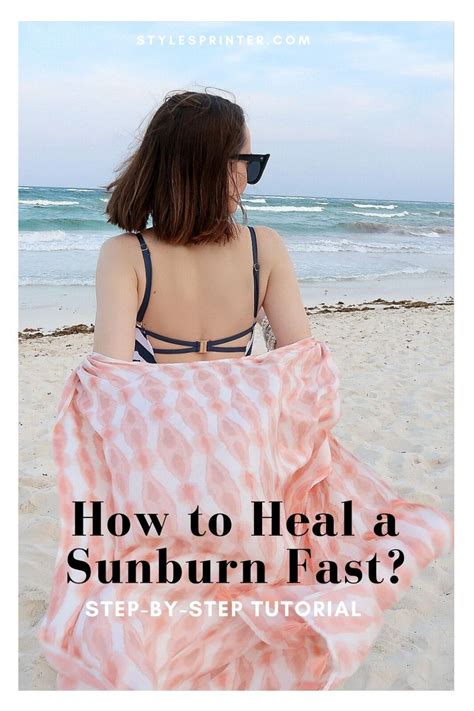 How To Heal A Sunburn Fast 10 Proven Sunburn Remedies