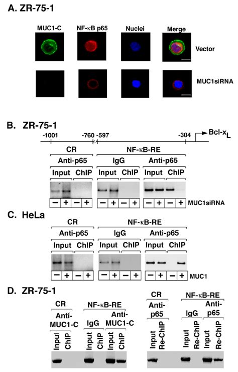 Muc1 C Promotes Occupancy Of Nf κ B P65 On The Bcl Xl Gene Promoter