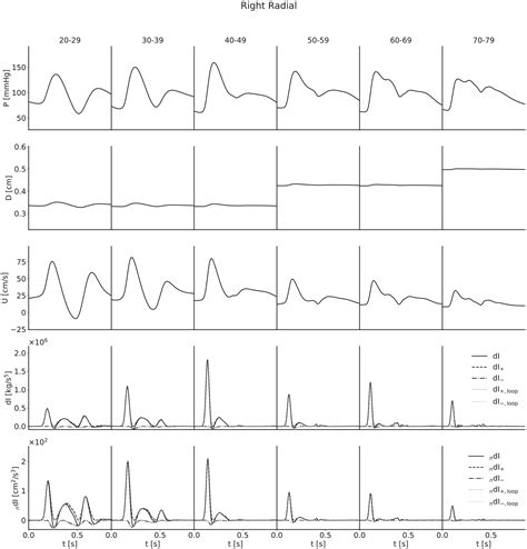 Comparison Of Arterial Wave Intensity Analysis By Pressure Velocity And
