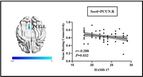 Negative Correlation Between The Fc Values Of Abnormal Brain Regions
