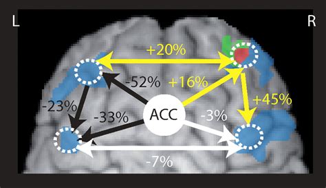 Decision Threshold Modulation In The Human Brain Journal Of Neuroscience