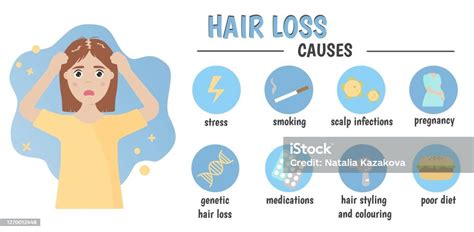 Medical Infographics Hair Loss Alopecia Stock Illustration Download