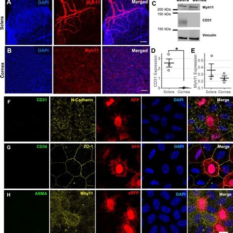 Myh11 Lineage Tracing Marks A Subpopulation Of Cells On The Basal