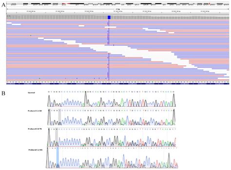 A Excerpt Of Whole Exome Sequencing From Proband Ii 3 Ts Visualised