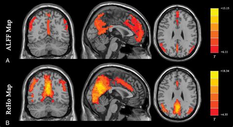 Resting State Functional Mri Everything That Nonexperts Have Always