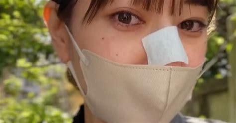 林みなほ、4歳児送迎後に坂道で“大惨事” 路面へ飛び散った血に「顔いっちゃったかと思って焦った」（1 2 ページ） ねとらぼ