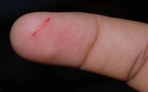 50 Hydrogen Peroxide Uses We Wish We Knew Sooner Hydrogen Peroxide
