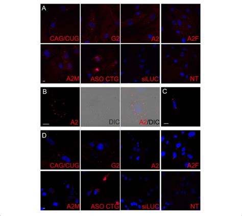 Localization Of Sirnas And Asos Targeting Cag Repeat Tract In
