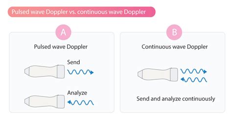 Continuous Wave Doppler Cw Doppler Cardiovascular Education