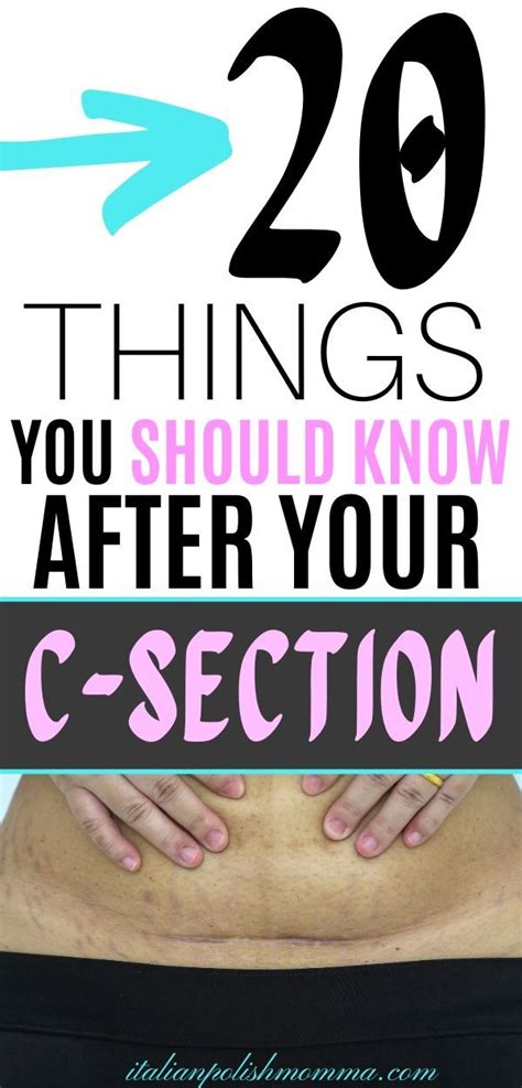 The Do S And Don Ts After A C Section Artofit
