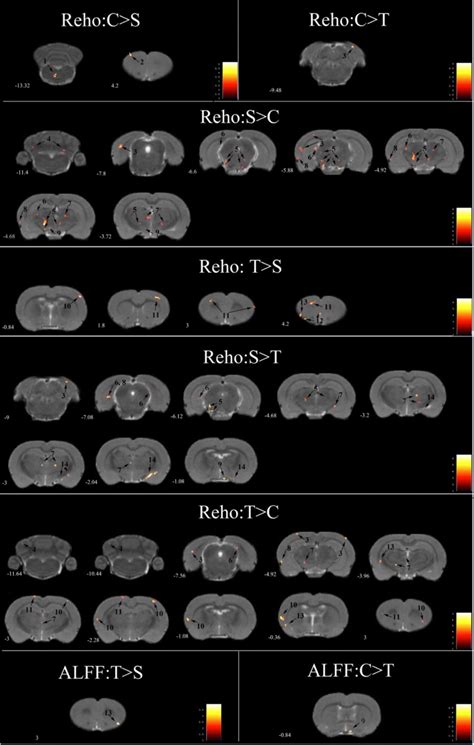 Statistical Maps Of Voxel T Values Of Reho And Alff Comparisons Of Two