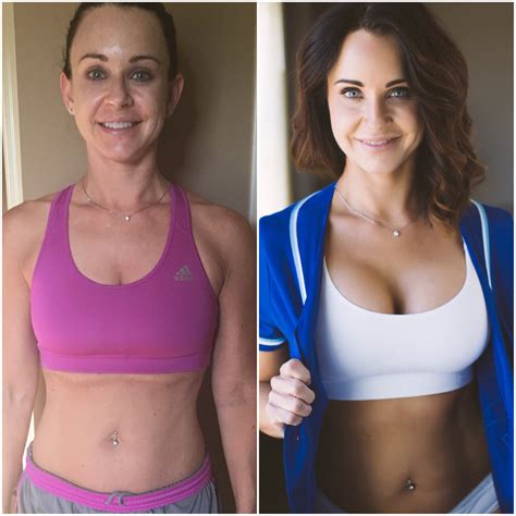 4 Weeks Post Breast Augmentation Cosmetic Surgery Tips