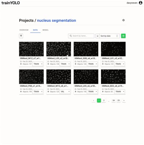 How To Train Yolov8 Segmentation On A Custom Dataset