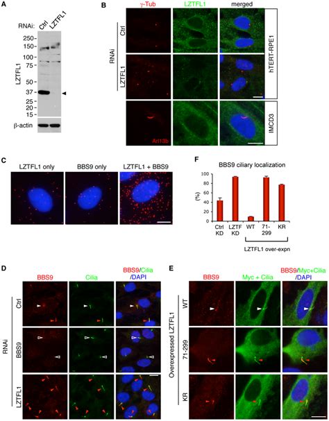 Lztfl1 Regulates Ciliary Trafficking Of The Bbsome A Verification Of