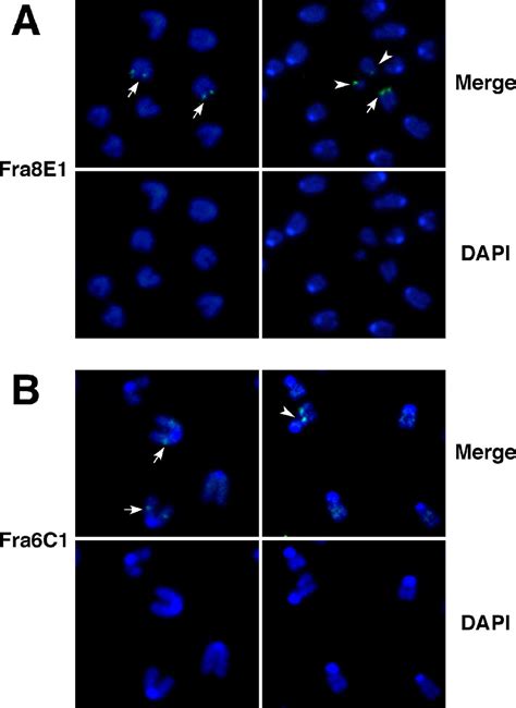Increased Common Fragile Site Expression Cell Proliferation Defects