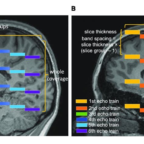 Spatial And Temporal Snr Of The Super Resolution Reconstructed Images