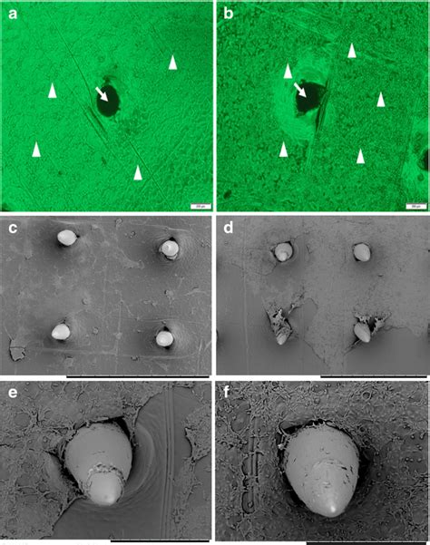Different Types Of Cells Attach To The Mns When The Cells Are Seeded