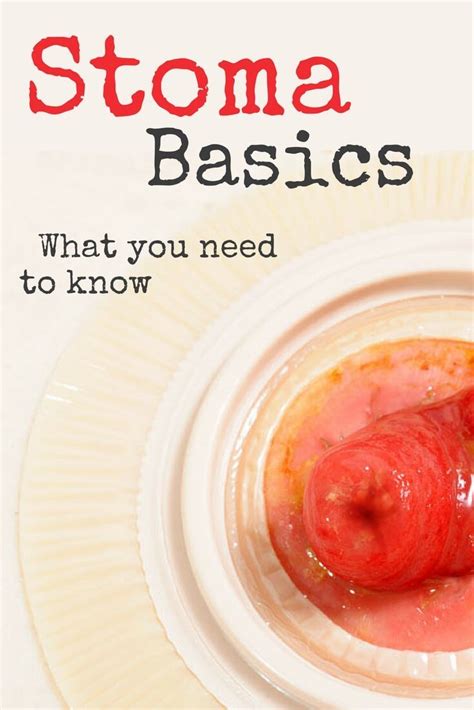 Stomas What You Need To Know There Are Two Main Types Of Stomas And