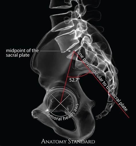 Pelvic Incidence Angle Artofit