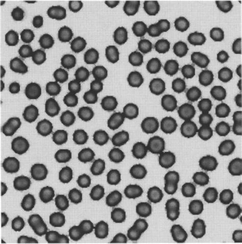 Figure 1 From Self Replicating Spots In Reaction Diffusion Systems