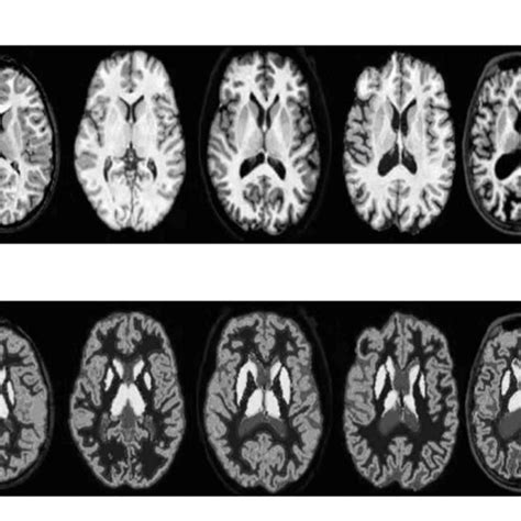 Process Of Three Dimensional 3d Multimodal Medical Image