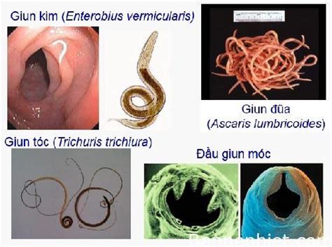Các Loại Giun Trong Cơ Thể Người Bạn Nên Biết
