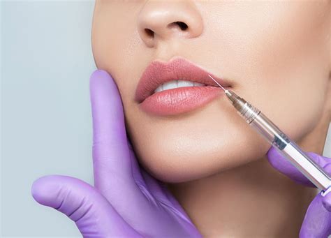 Ácido Hialurônico Preenchimento Labial Dr Marcos Kawasaki