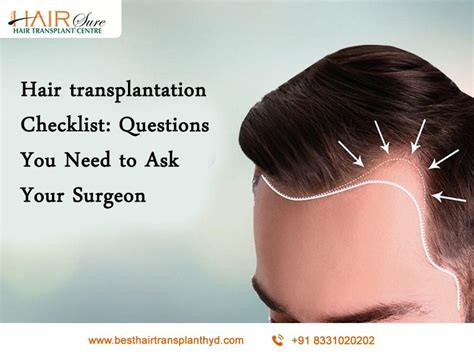 Hair Transplantation Checklist Questions You Need To Ask Your Surgeon