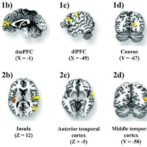 Sex Is Associated With The Ifc Of The Dmn Default Mode Network The