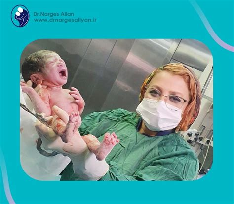 زایمان طبیعی خانم جبارزاده دکتر نرگس علیان بهترین متخصص زنان و زایمان