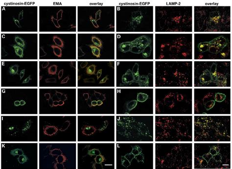 Effect Of Cystinosis Associated Mutations On The Subcellular