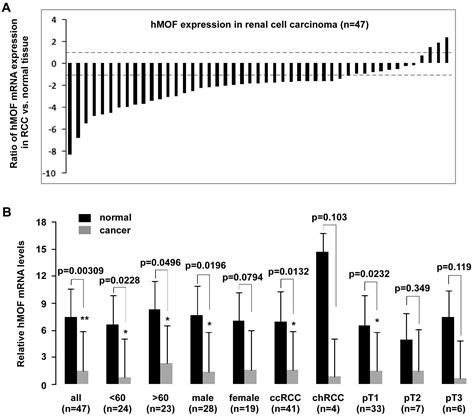 Correlation Of Low Expression Of Hmof With Clinicopathological Features