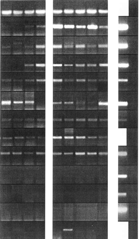Reverse Transcriptase Polymerase Chain Reaction Analysis Of Cytokine