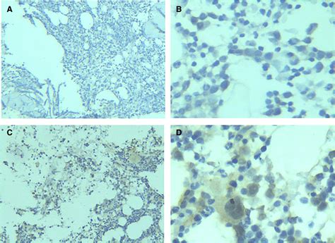 Hif‐1α Expression In The Myeloid Tissues Of The Controls A After
