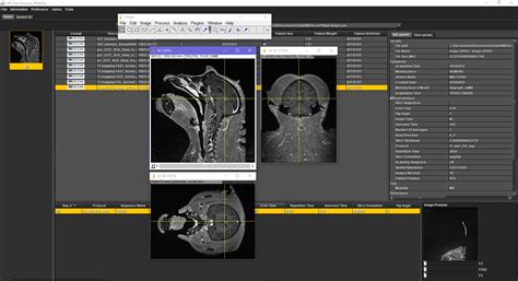 mri file manager irmage