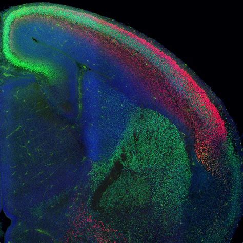 Stem Cells From One Cell To Billions